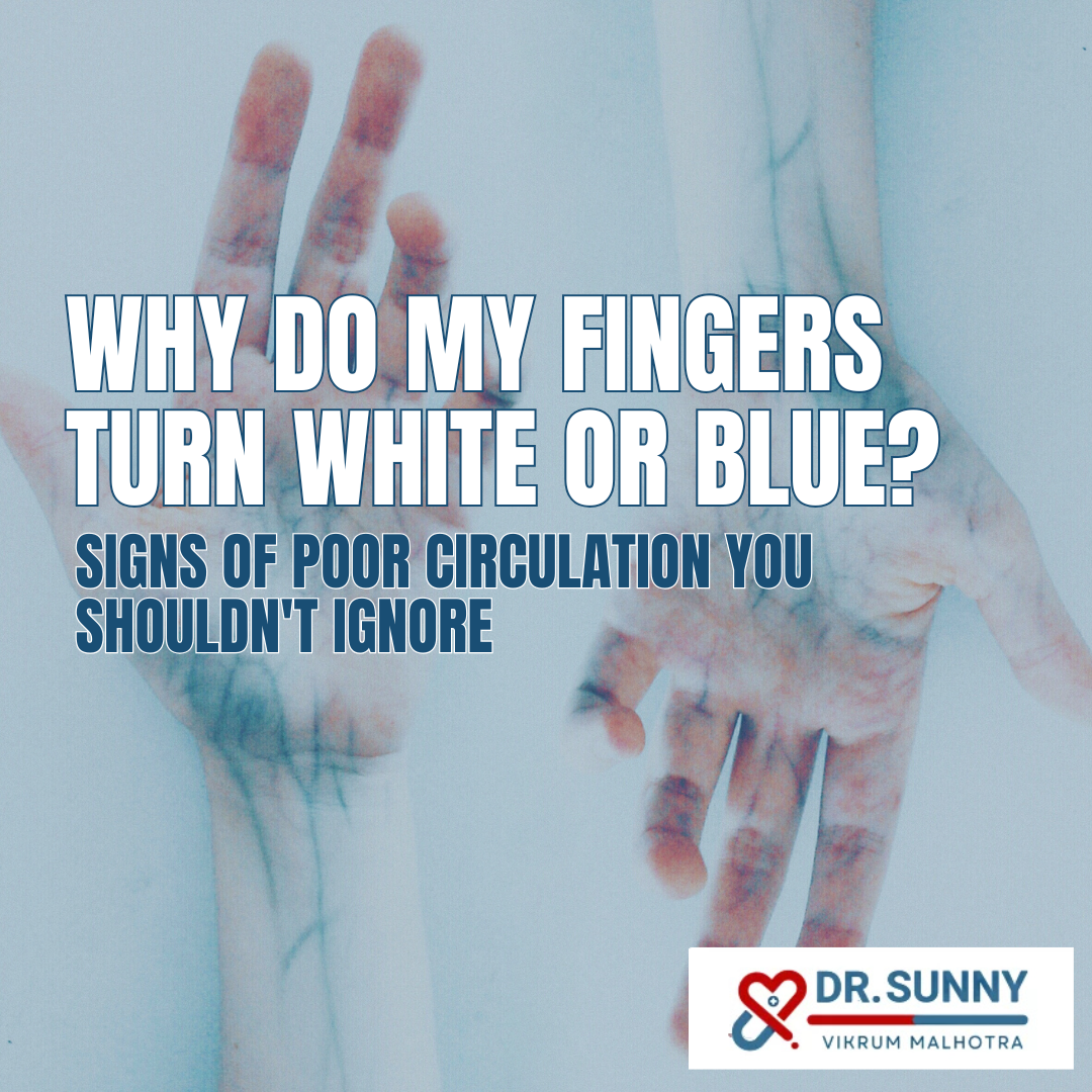 Why Do My Fingers Turn White or Blue? Signs of Poor Circulation You ...